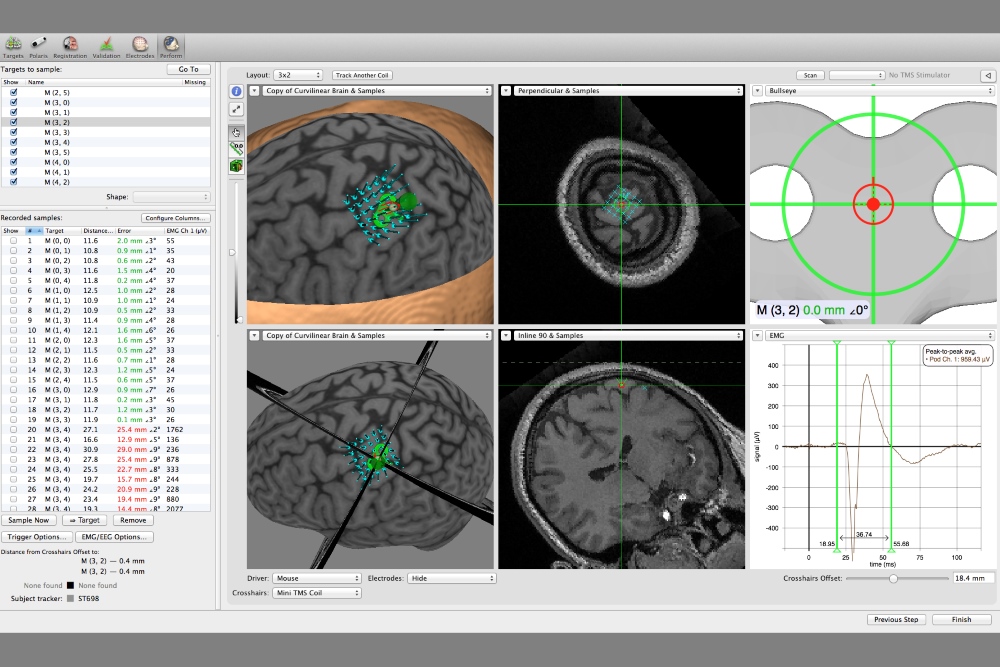 Brainsight TMS - neuroCare Group